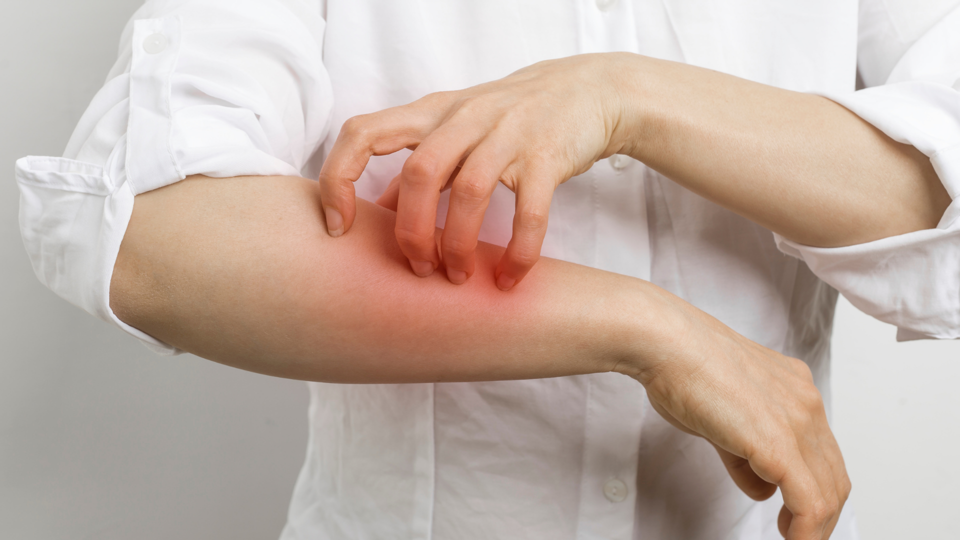 Bu çiçekleri gördüğünüzde kaçın! Kaşıntı, nefes darlığı ve hapşırık ...